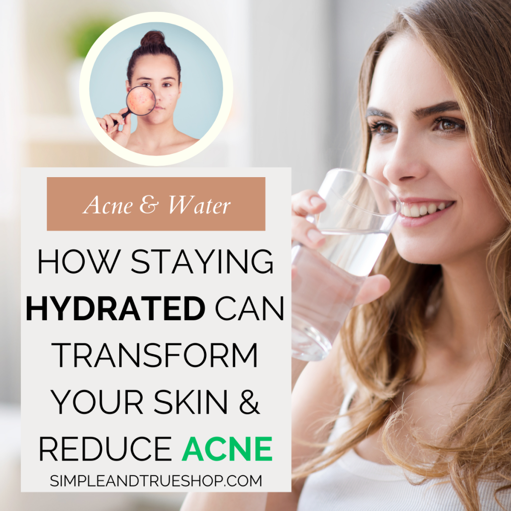 How Staying Hydrated Can Transform Your Skin - Simple and True
